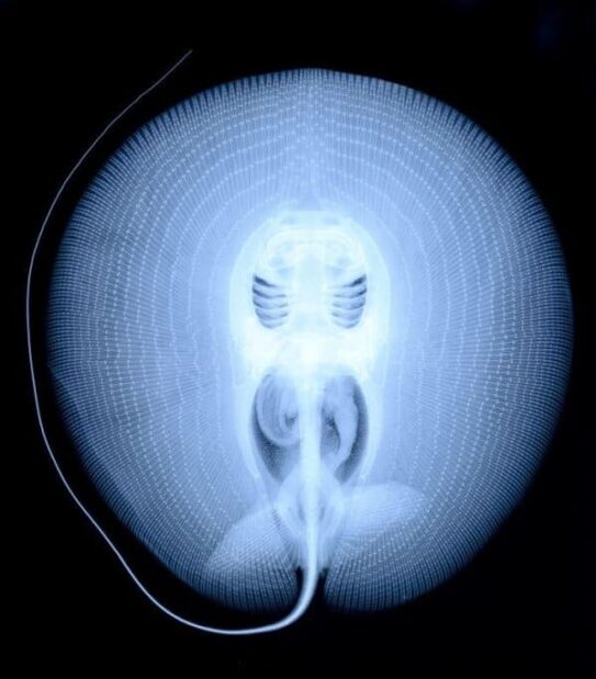 30 Interesting X-Rays Of Things You've Probably Never Seen X-Rayed Before