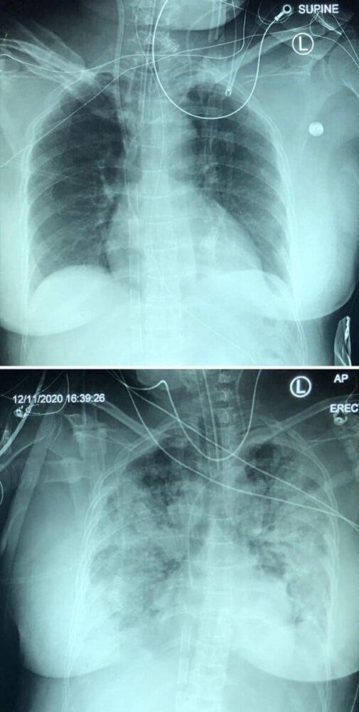 30 Interesting X-Rays Of Things You've Probably Never Seen X-Rayed Before