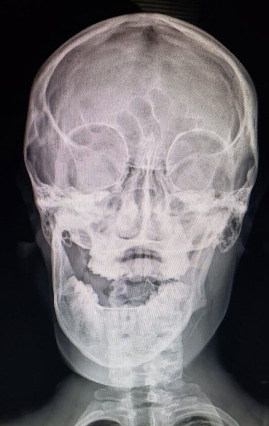 30 Interesting X-Rays Of Things You've Probably Never Seen X-Rayed Before