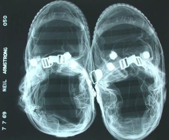 30 Interesting X-Rays Of Things You've Probably Never Seen X-Rayed Before