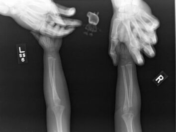 30 Interesting X-Rays Of Things You've Probably Never Seen X-Rayed Before