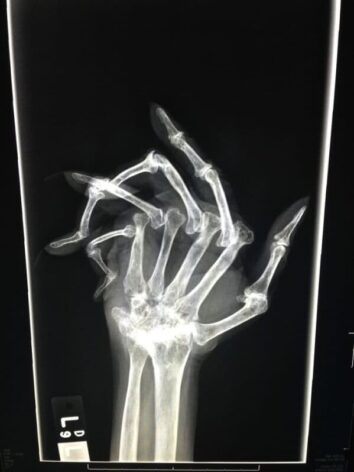 30 Interesting X-Rays Of Things You've Probably Never Seen X-Rayed Before