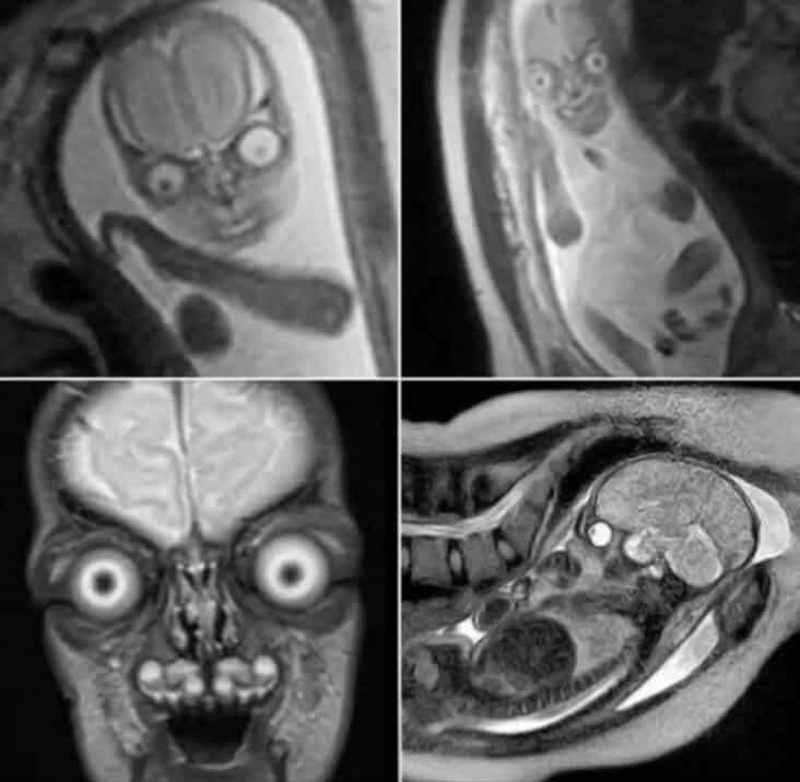 25+ Oddly Terrifying Photos You'll Hope Are Glitches In The Matrix