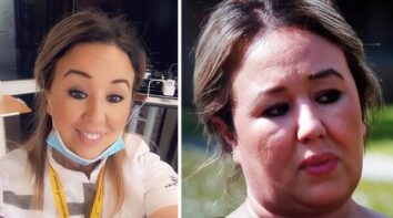 40 Hilariously Over-Photoshopped Pictures Of Influencers That Are ...