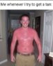 35 Funny Sunburn Memes For Us Pale-Skinned Summer Warriors Who Don't ...