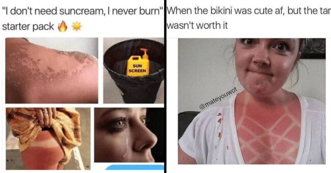 35 Funny Sunburn Memes For Us Pale-Skinned Summer Warriors Who Don't ...