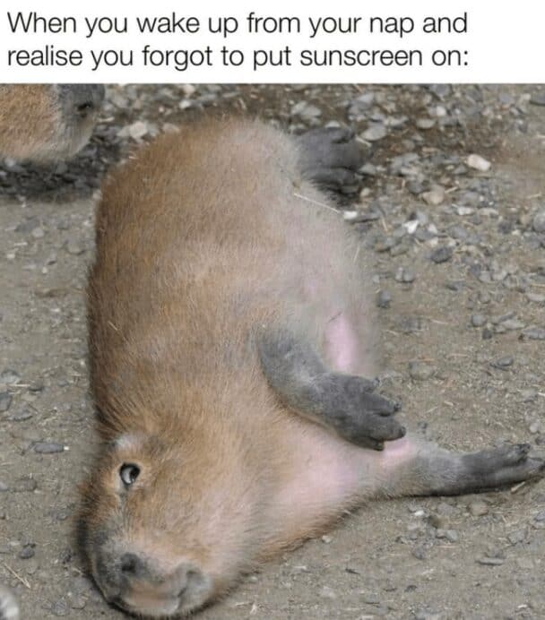 35 Funny Sunburn Memes For Us Pale-Skinned Summer Warriors Who Don't ...