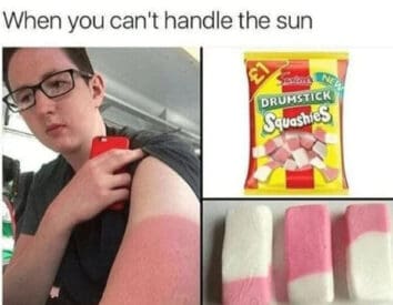 35 Funny Sunburn Memes That'll Have You Reaching For The Sunscreen ...