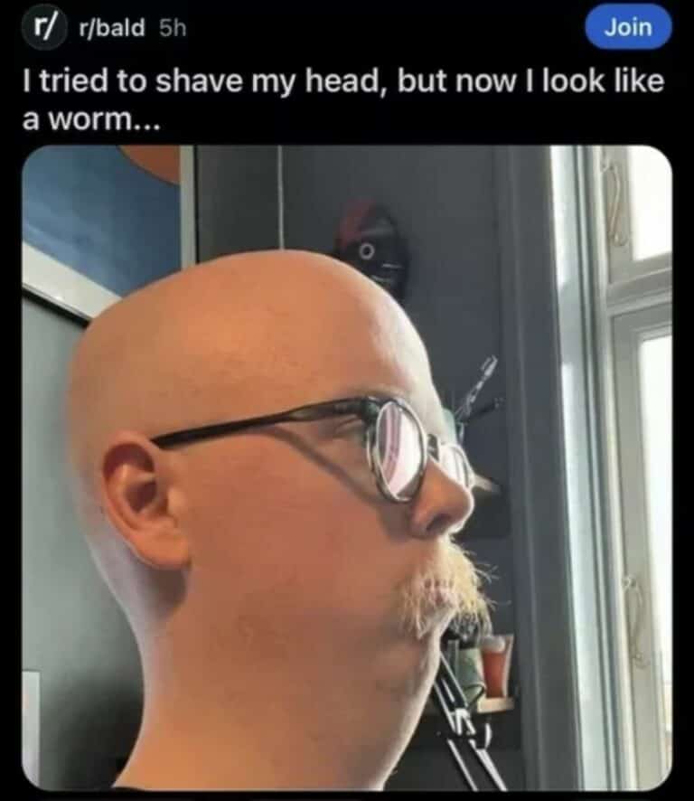 32 Shiny Bald Memes For The Follicly Challenged With An Abundance Of Humor