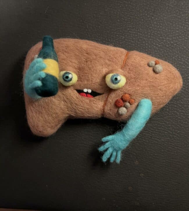 35 Great (And Hilariously Bad) Needle Felting Art Projects From Masters ...