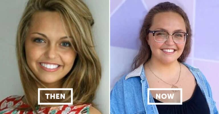 40 Before-And-After "Glow Downs" Showing People Who "Peaked" Early